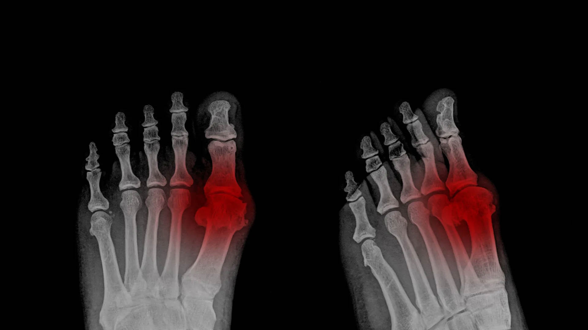 Podiatry | George Gendy MD